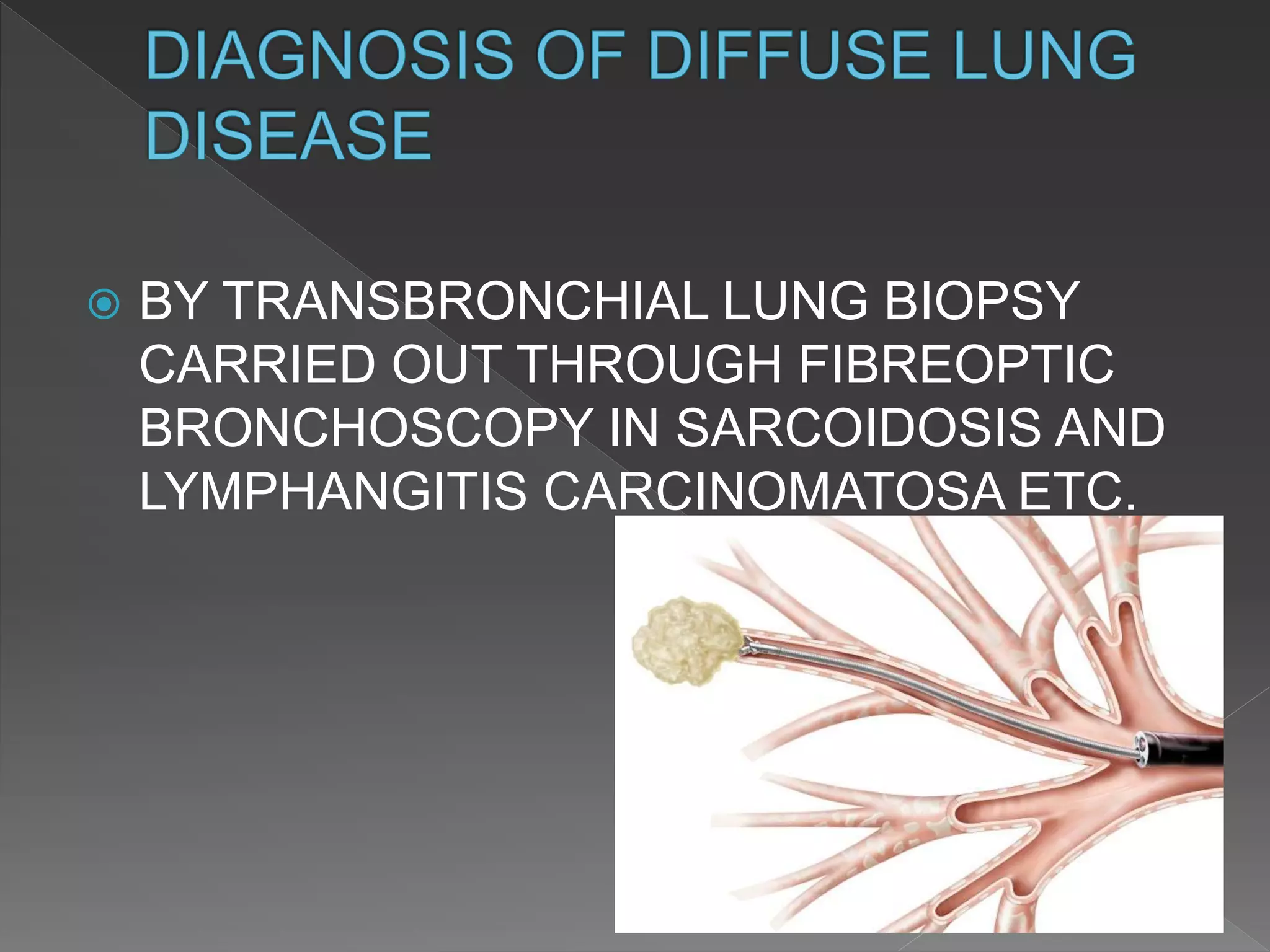 Bronchoscopy | PPTX
