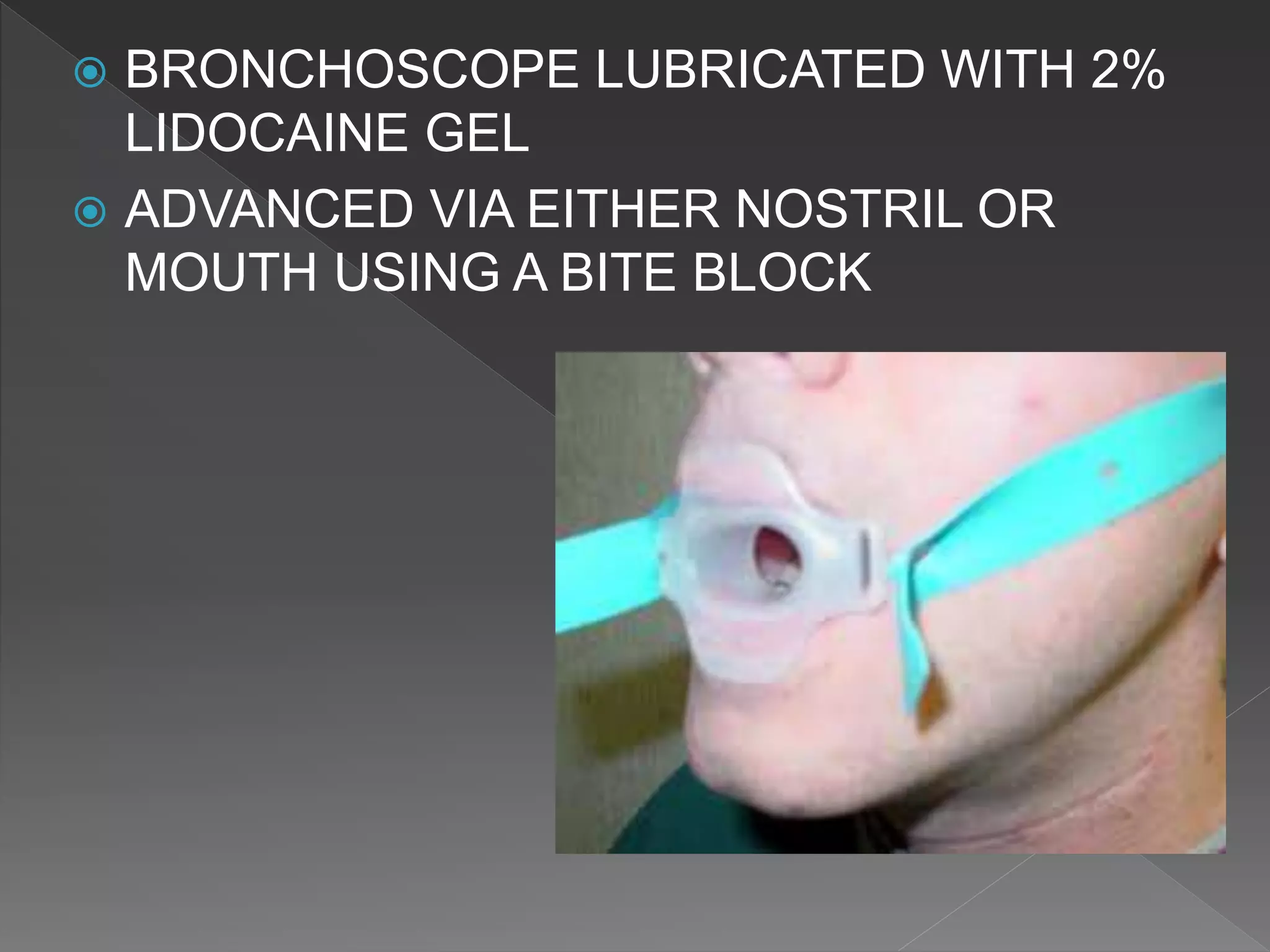Bronchoscopy | PPTX