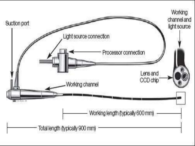 Bronchoscopy | PPTX