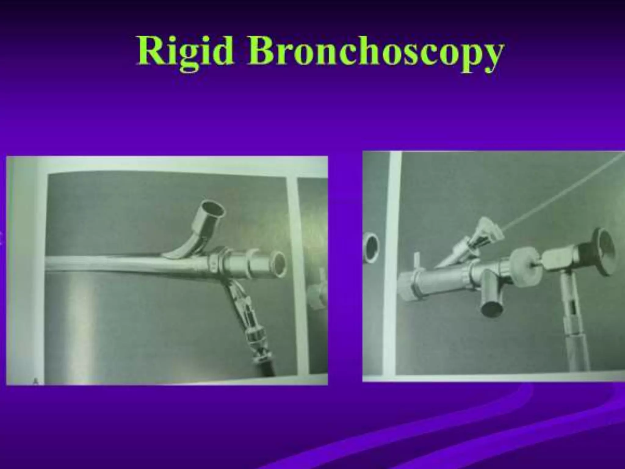 Bronchoscopy | PPTX