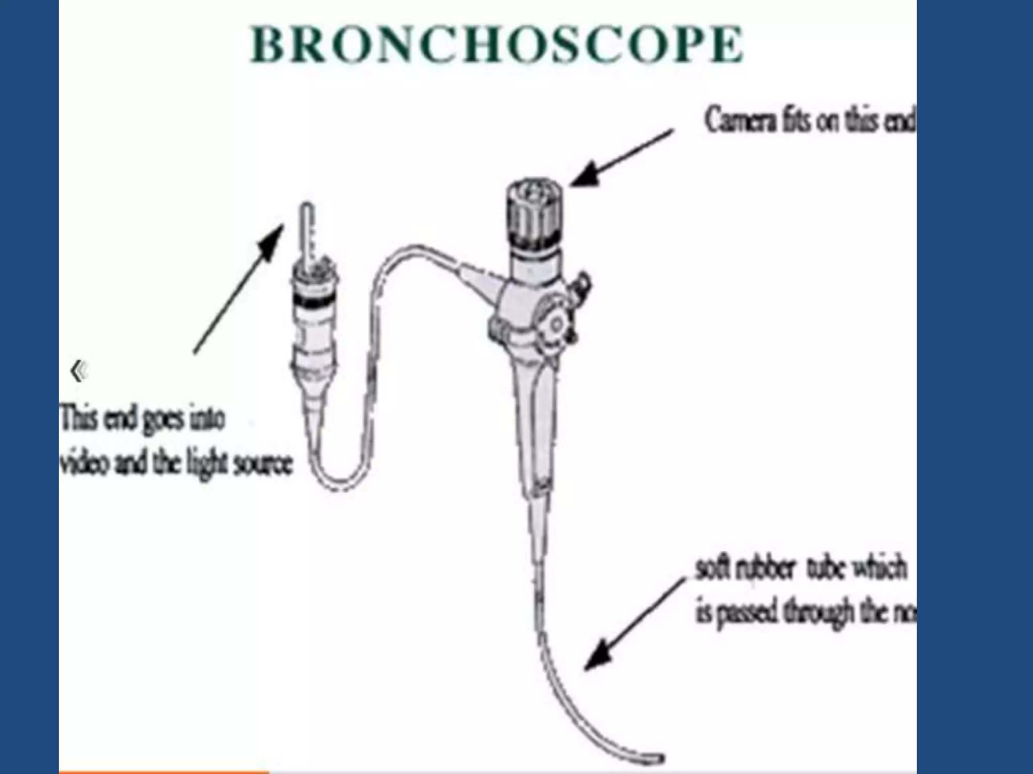 Bronchoscopy | PPTX