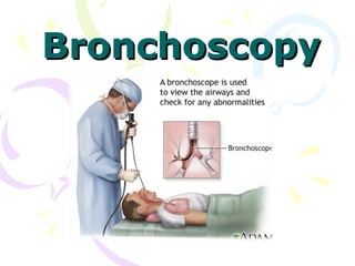 Bronchoscopy, Diagnostic technique | PPT