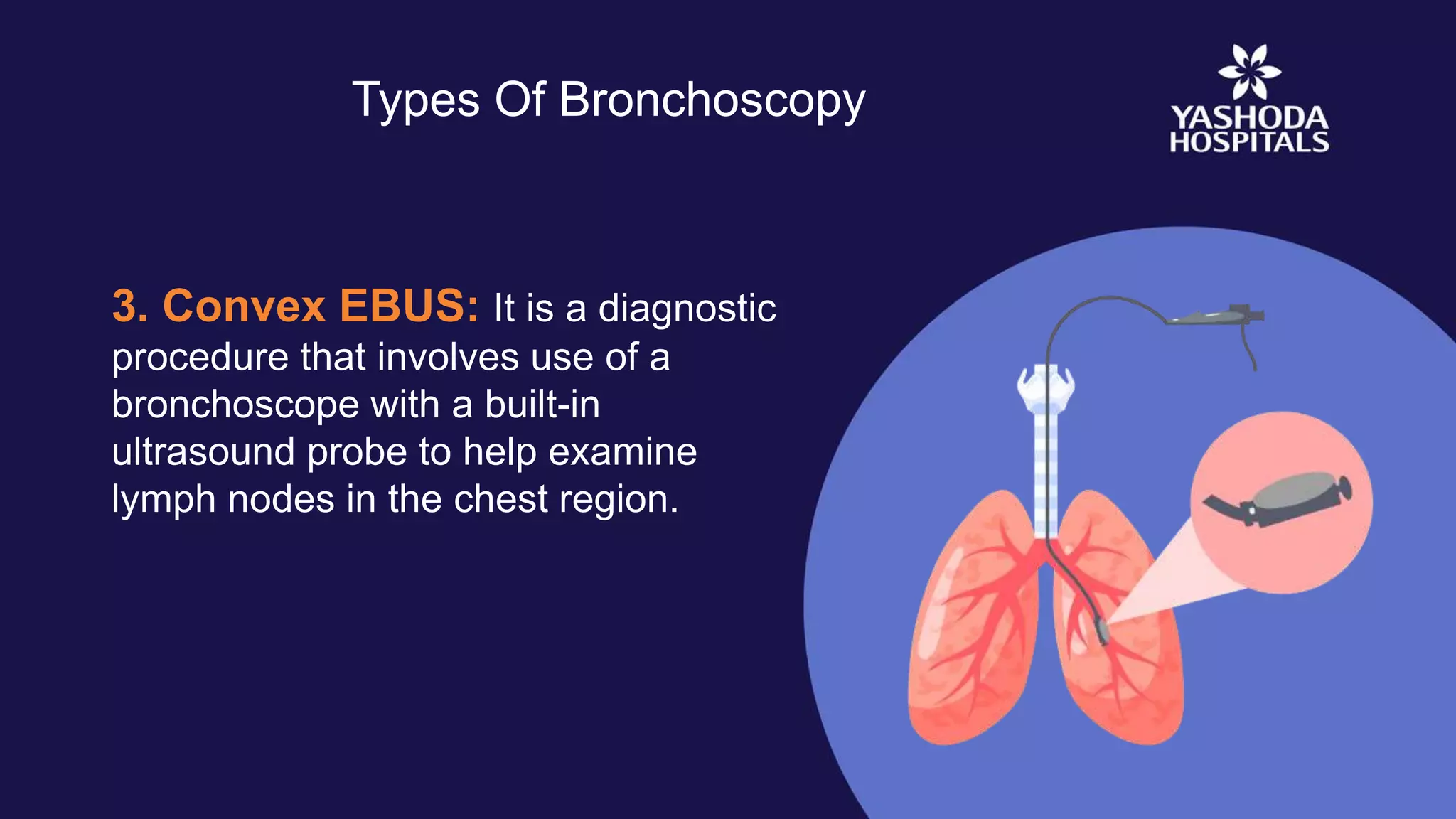 Bronchoscopy For Lung Diseases | PPTX