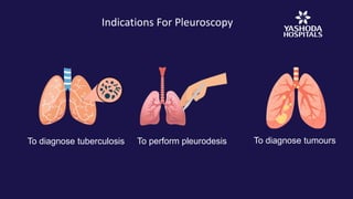 Bronchoscopy For Lung Diseases | PPT