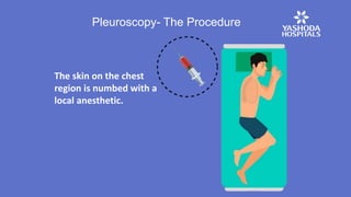 Bronchoscopy For Lung Diseases | PPT