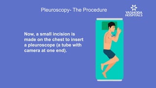 Bronchoscopy For Lung Diseases | PPT