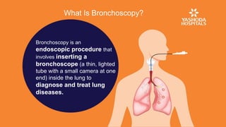 Bronchoscopy For Lung Diseases | PPT