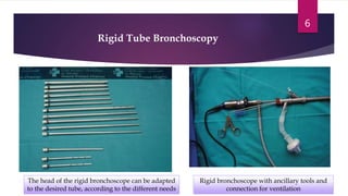 BRONCHOSCOPY.pptx | Lung and Respiratory Health | Diseases and Conditions