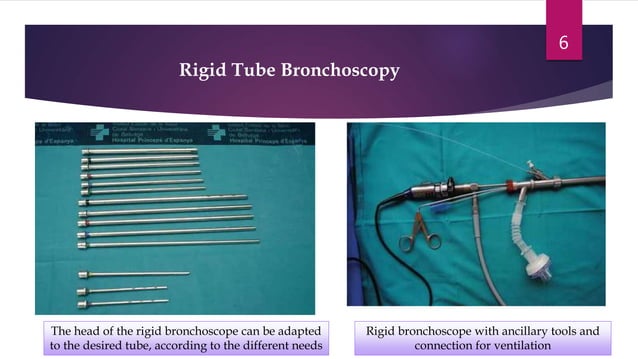 BRONCHOSCOPY.pptx | Lung and Respiratory Health | Diseases and Conditions