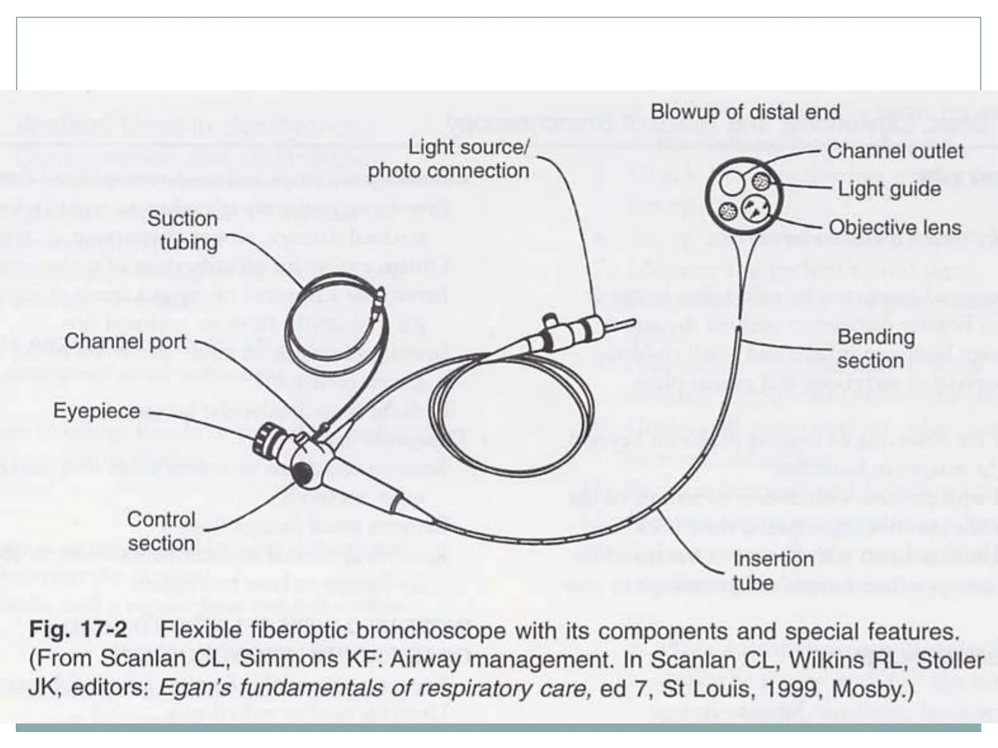 fiberoptic bronchoscopy - airway securing FOI | PPTX