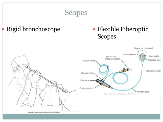 fiberoptic bronchoscopy - airway securing FOI | PPTX | Lung and ...