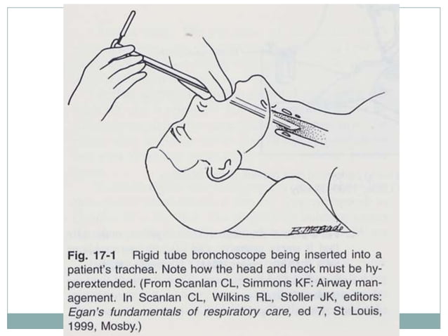 fiberoptic bronchoscopy - airway securing FOI | PPTX | Lung and ...
