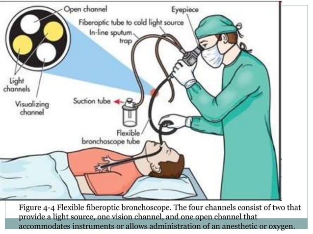 fiberoptic bronchoscopy - airway securing FOI | PPTX | Lung and ...