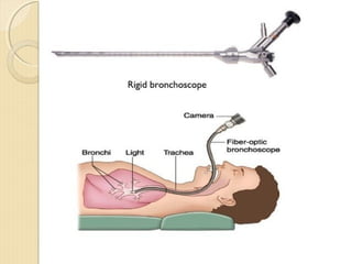 bronchoscopy - airway equipments.pptx