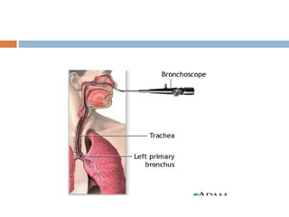 Bronchoscopy | PPT