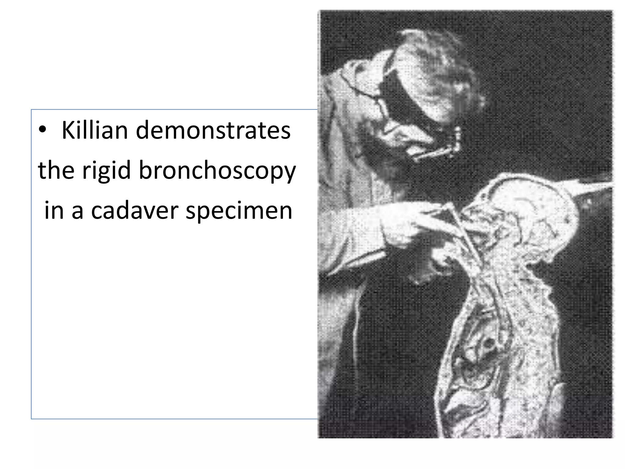 Bronchoscopy basics history current applications | PPTX