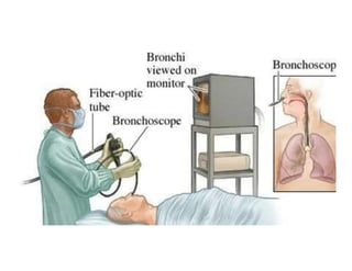 bronchoscopy 2022 .....pdf