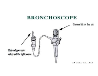 bronchoscopy 2022 .....pdf