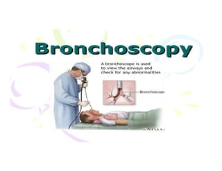 bronchoscopy 2022 .....pdf