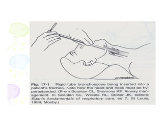 bronchoscopy 2022 .....pdf