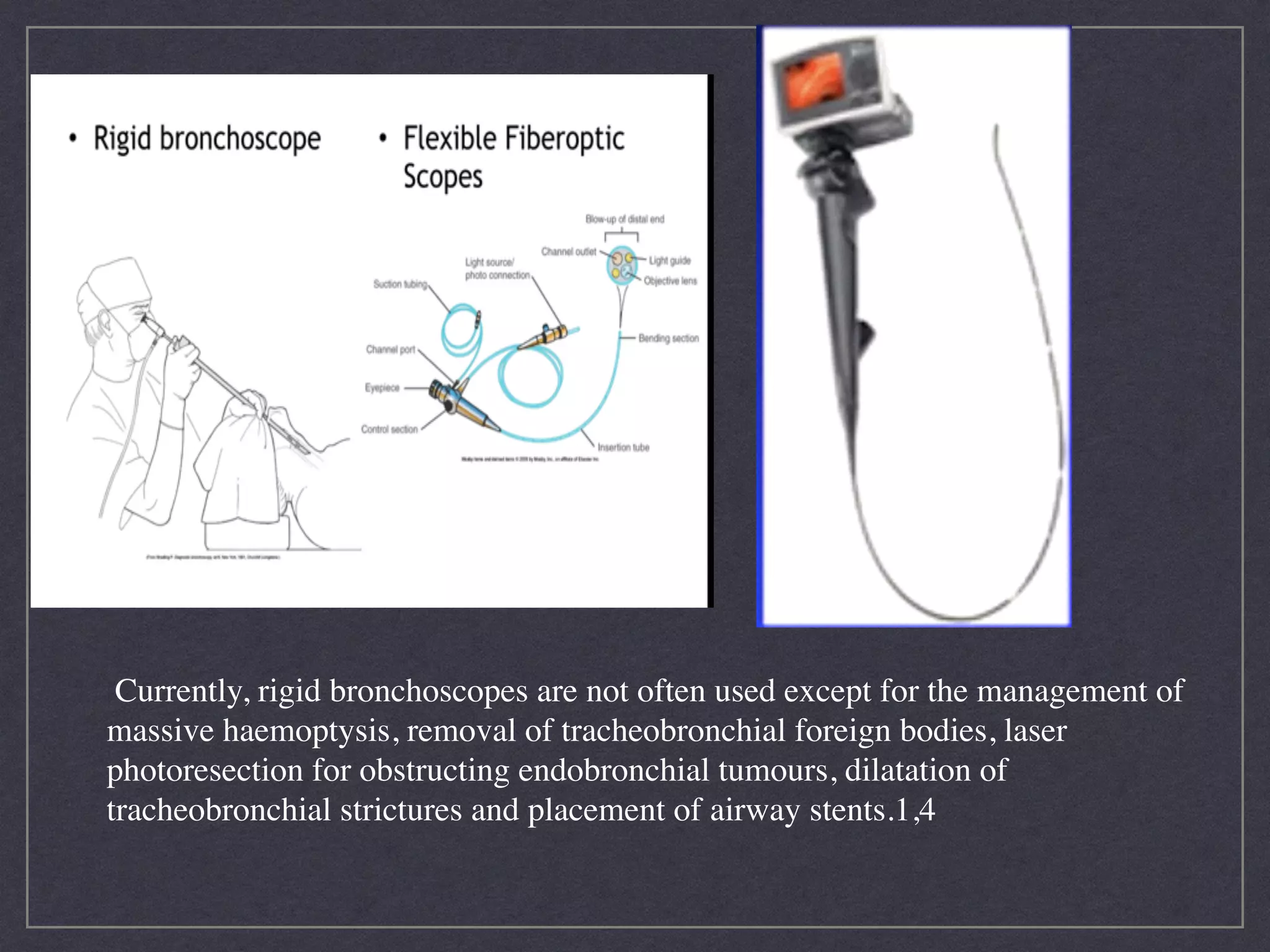 Bronchoscopy in icu and anesthesia | PDF