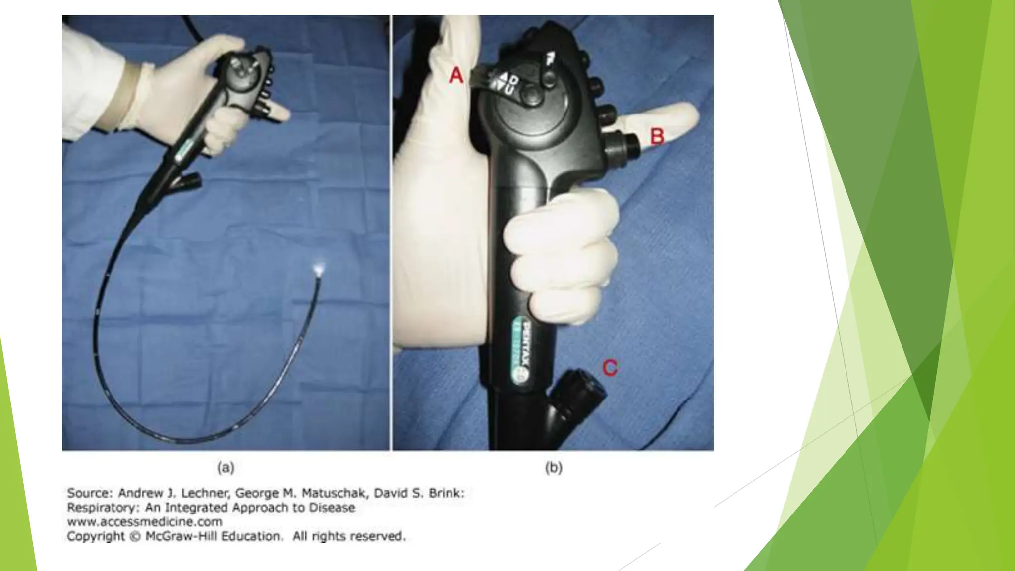 Flexible Bronchoscopy(Basic Diagnostic).pptx
