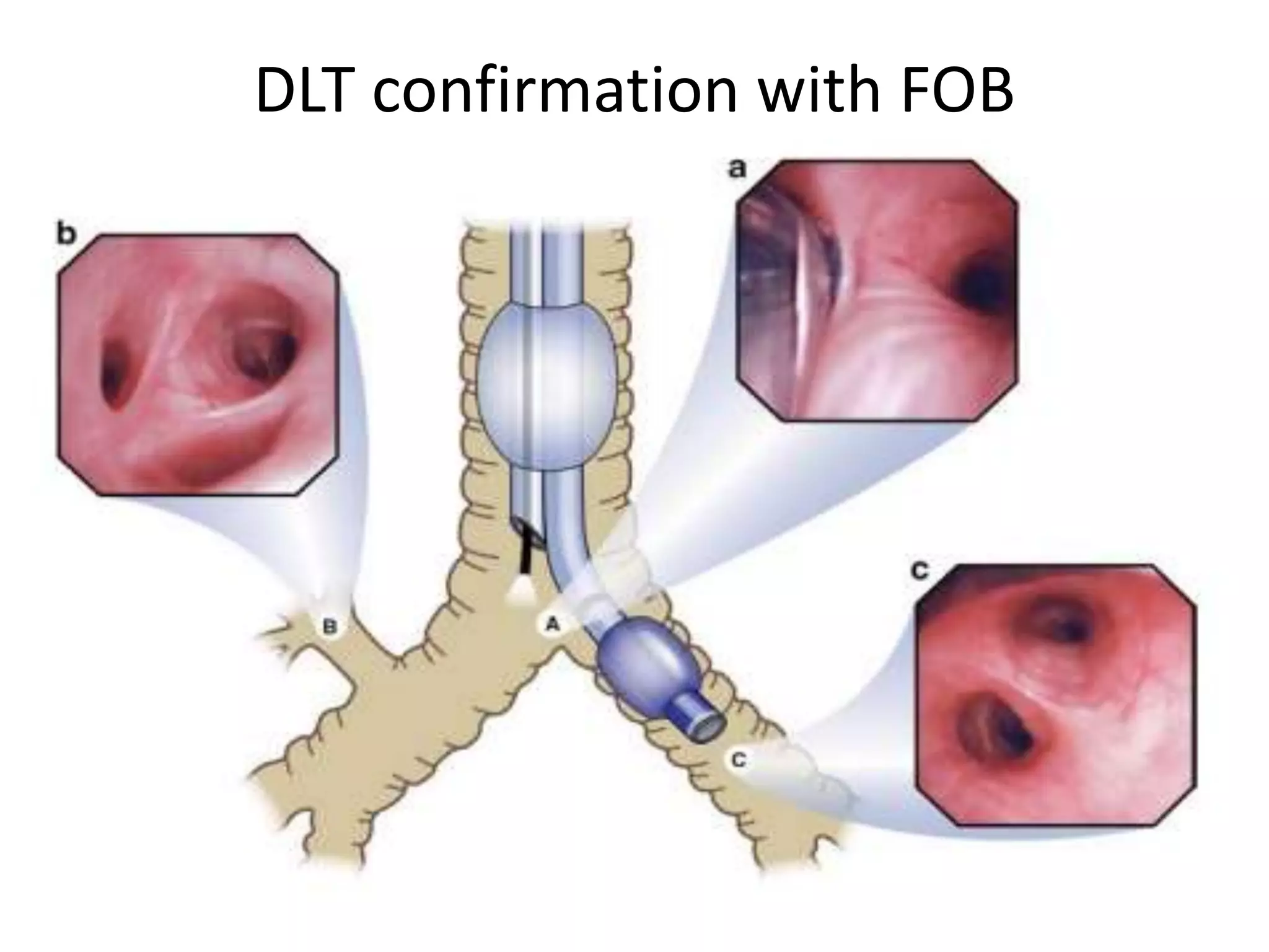 bronchoscopy workshop.pptx