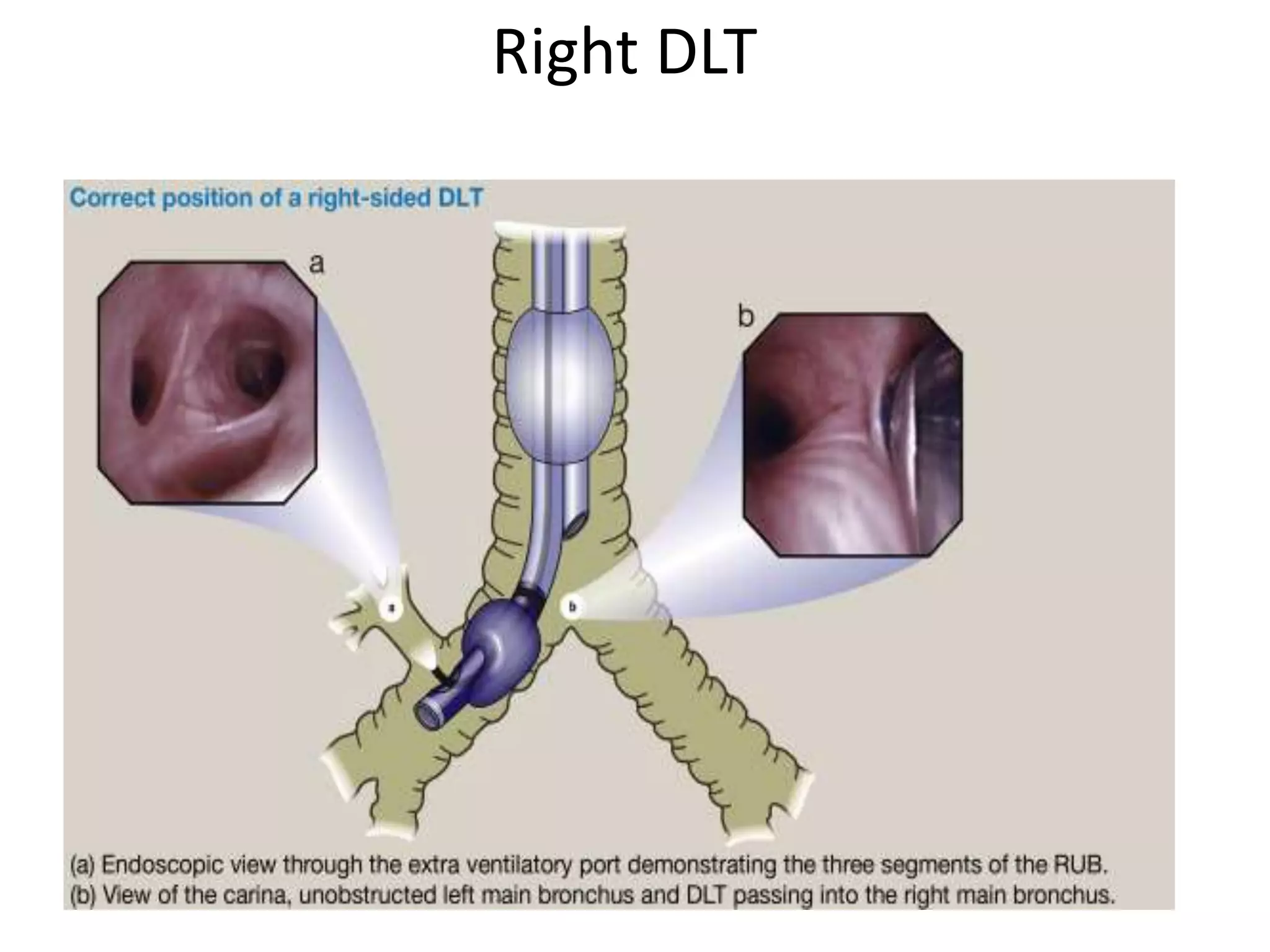 bronchoscopy workshop.pptx