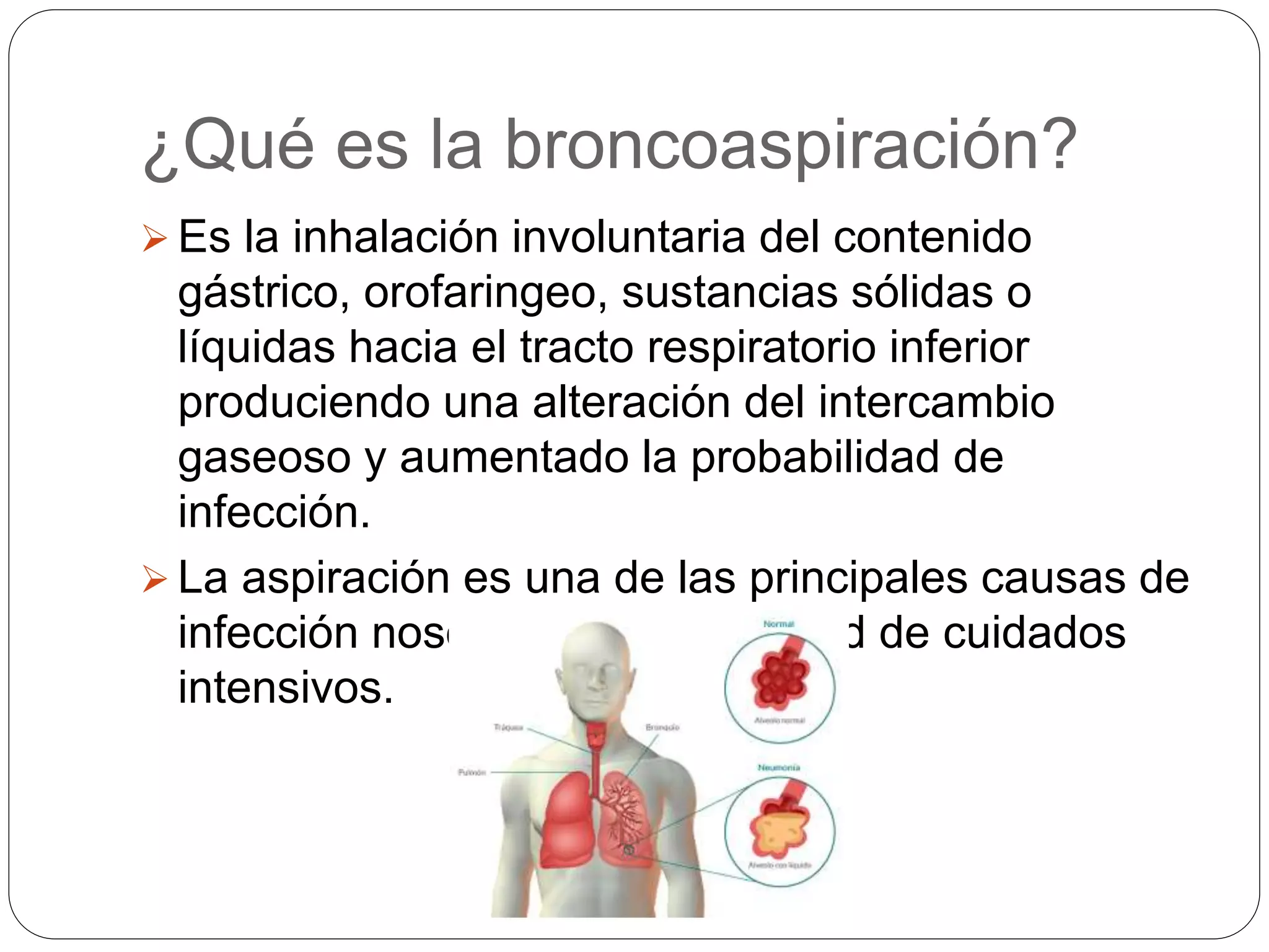Broncoaspiración | PPTX