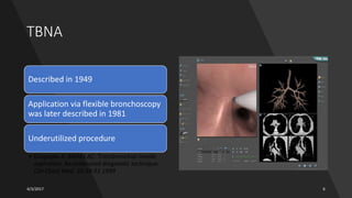 Does a short course in EBUS-TBNA improve yield of conventional TBNA | PPTX