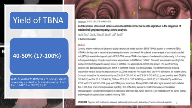 Does a short course in EBUS-TBNA improve yield of conventional TBNA