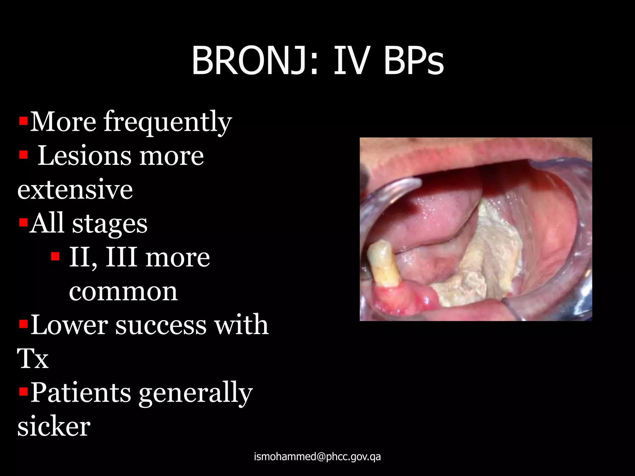 MRONJ | PDF | Bone and Joint Conditions | Diseases and Conditions