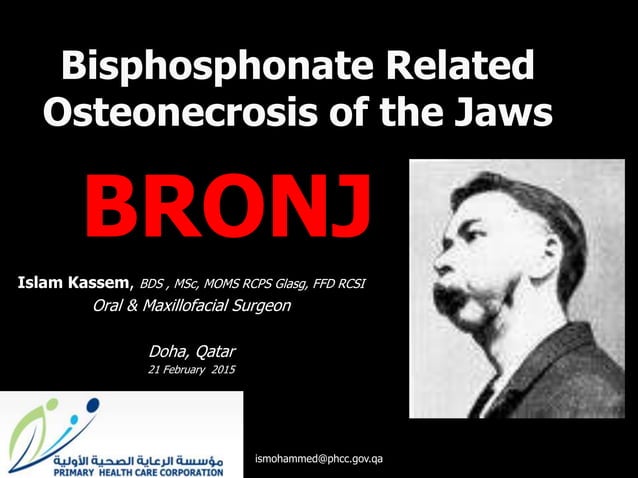 MRONJ | PDF | Bone and Joint Conditions | Diseases and Conditions