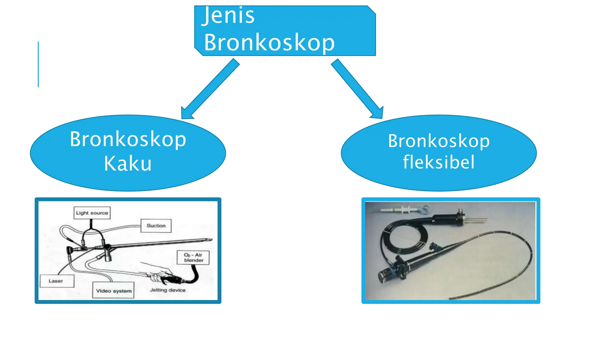 Bronkoskopi procedure of lung examination .pptx