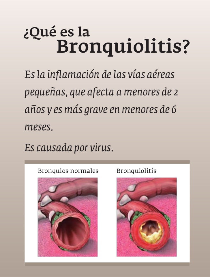 Bronquiolitis