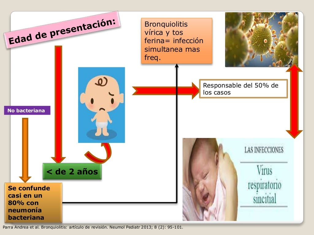Bronquiolitis Pediatría