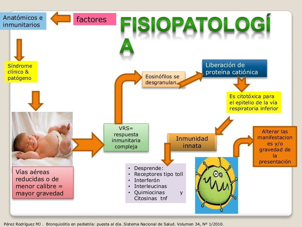 Bronquiolitis Pediatría