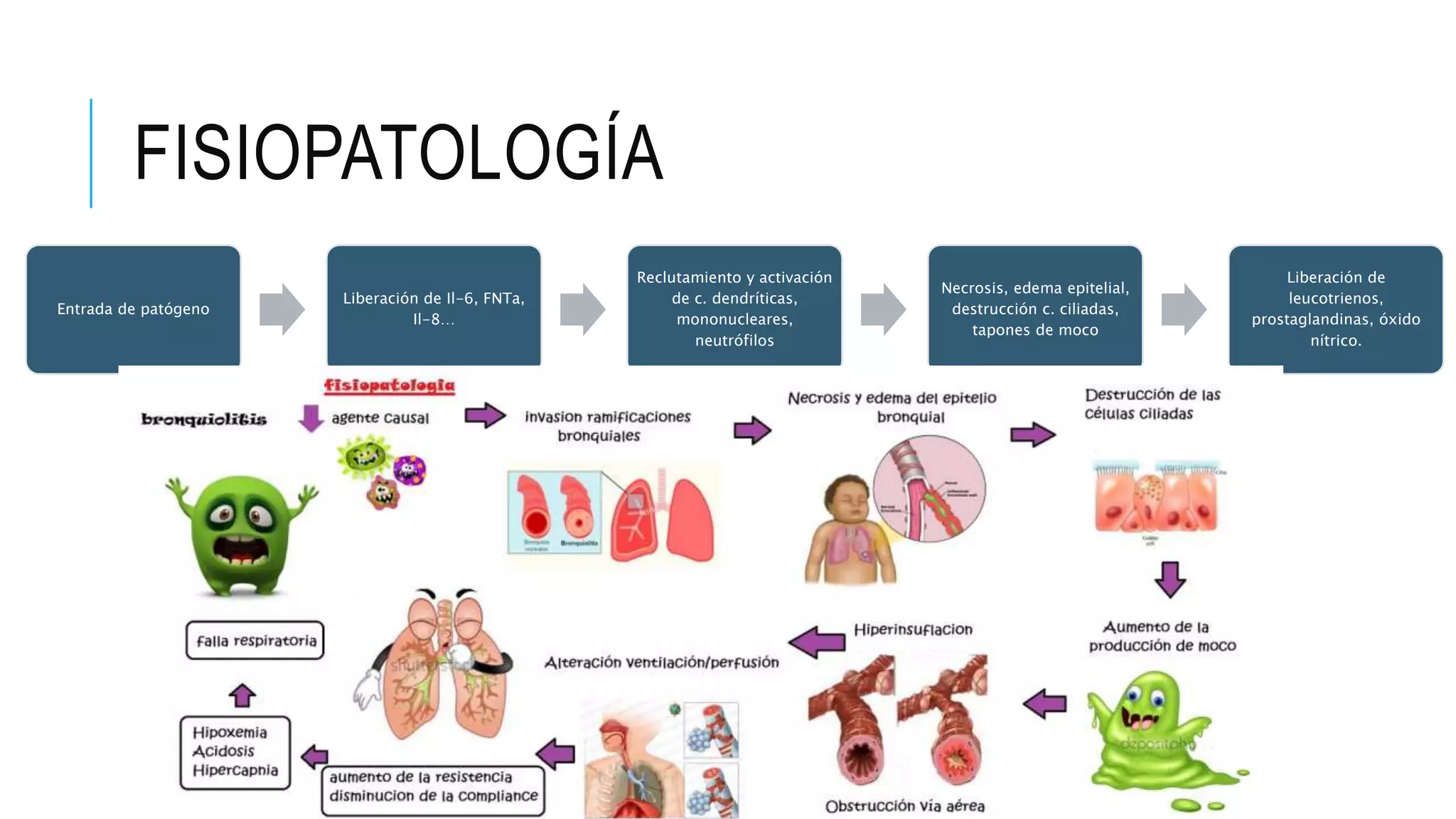 Bronquiolitis | PPTX