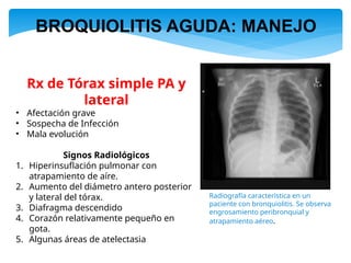 BRONQUIOLITIS_AGUDA_Minerva_Meza[1].pptx