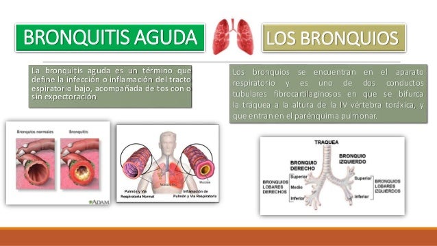 ¿qué es la bronquitis aguda y cómo detectarla? – bronquitis aguda tratamiento | XAKY