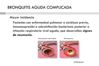 Bronquitis aguda | PPT