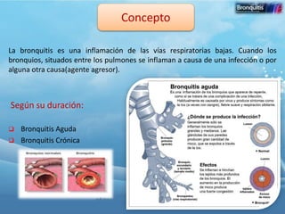 Bronquitis Aguda Pulmones