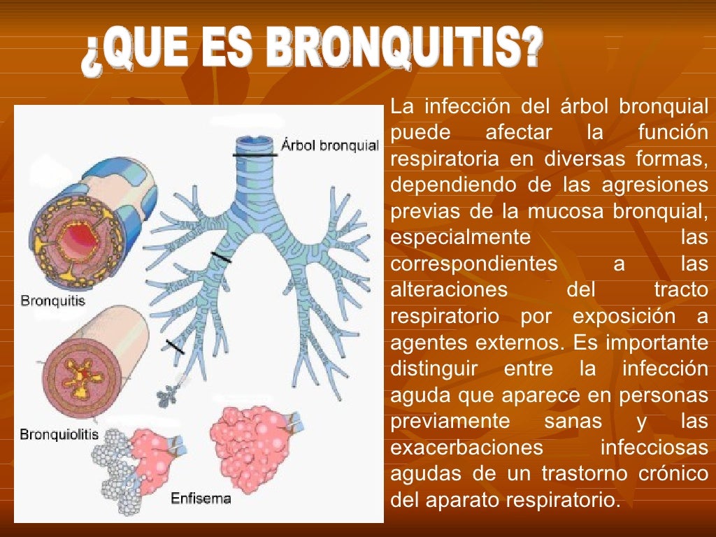 Bronquitis completo
