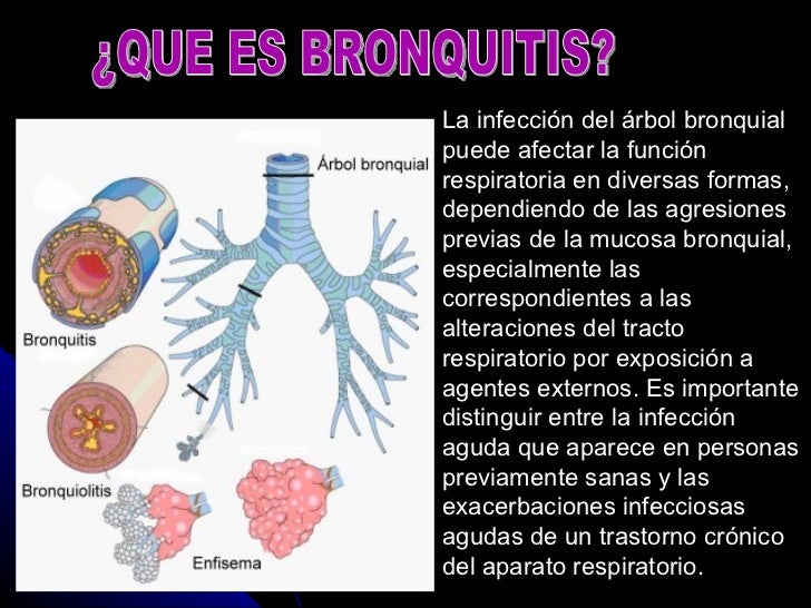 Bronquitis