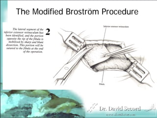 BroströM Procedure Presentation | PDF