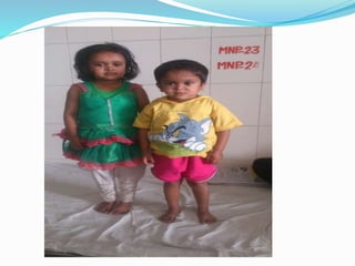Laron dwarf --Brother and sister | PPTX