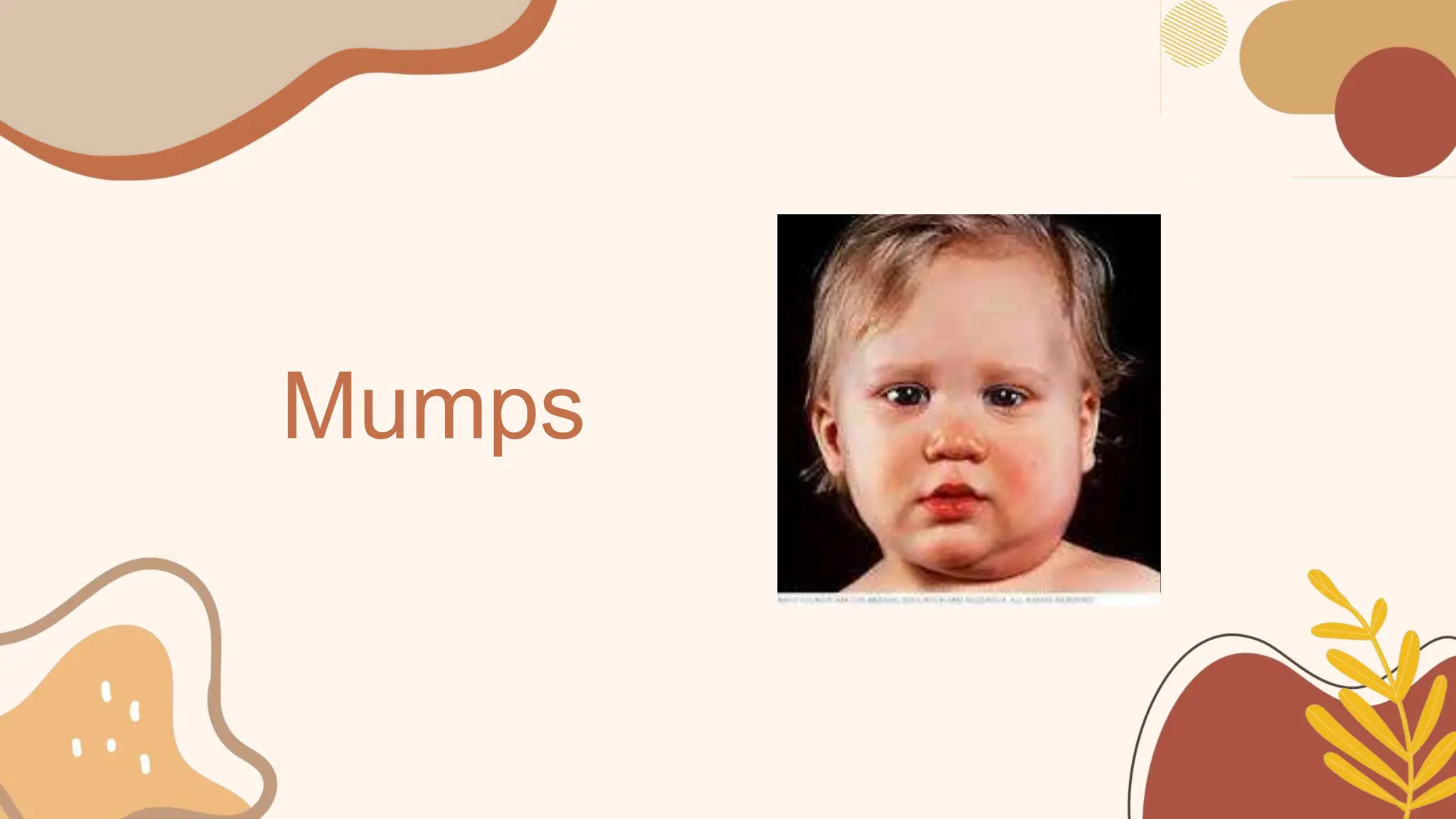 Communicable Disease Mumps Community Health Nursing | PPTX