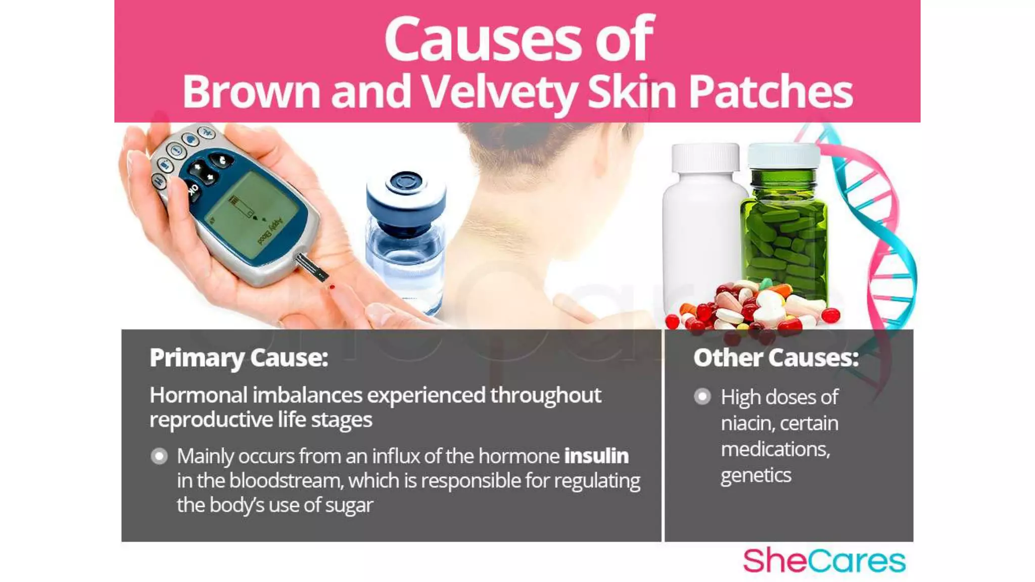Brown and velvety skin patches infographics - SheCares | PPTX