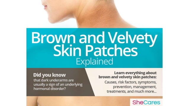 Brown and velvety skin patches infographics - SheCares | PPTX