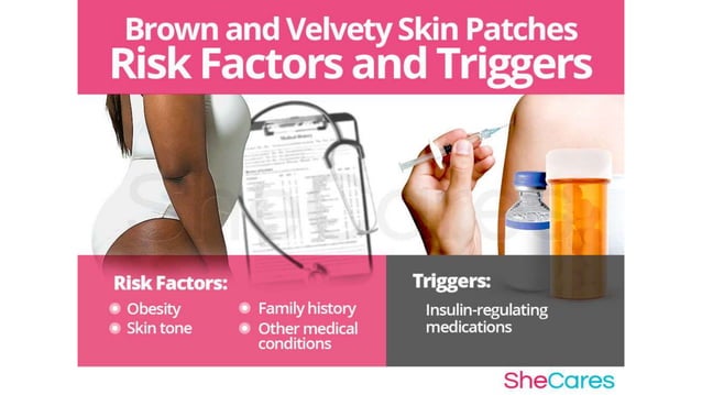 Brown and velvety skin patches infographics - SheCares | PPTX